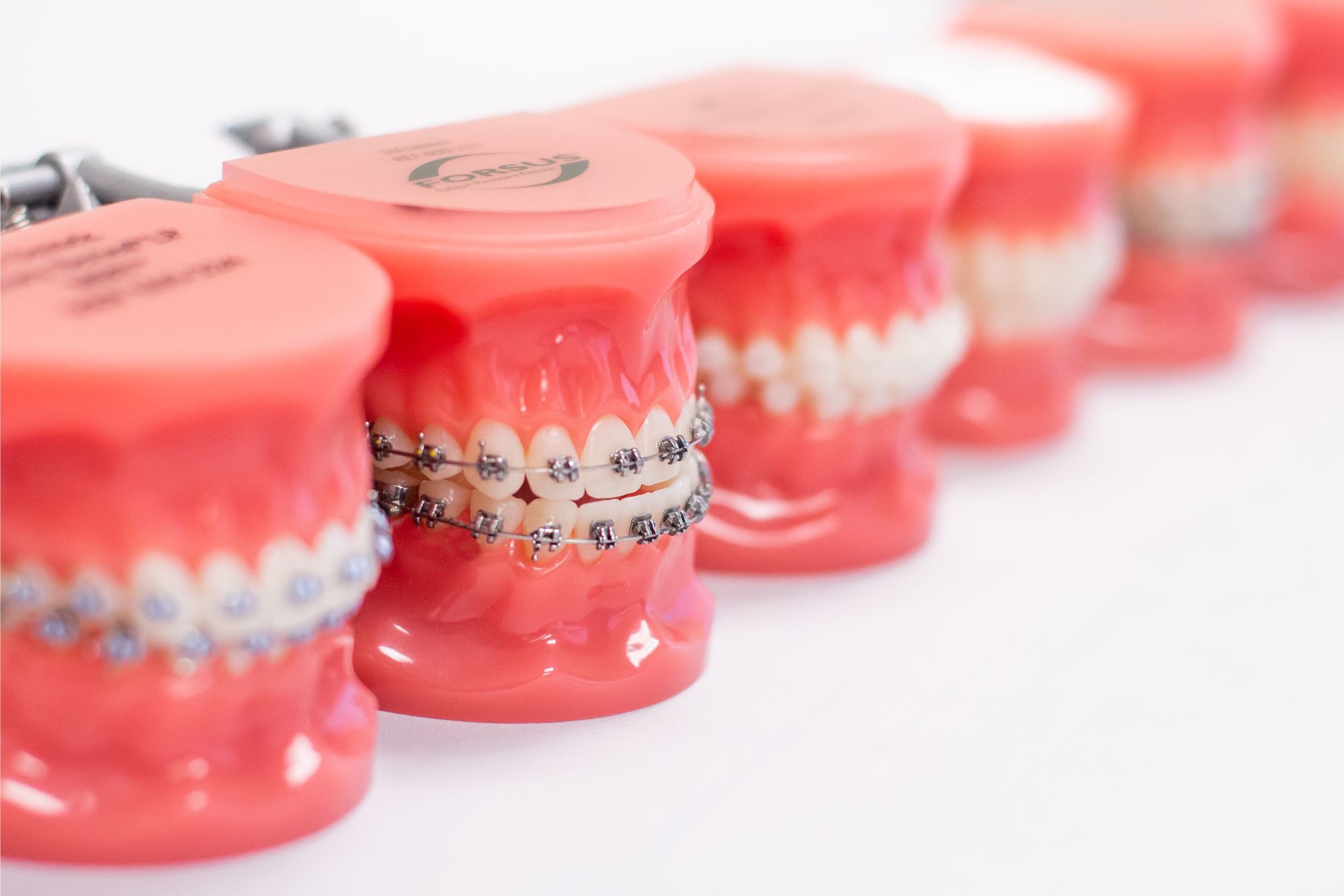 Treatment Options - Eastern Virginia Orthodontics - Family Orthodontist